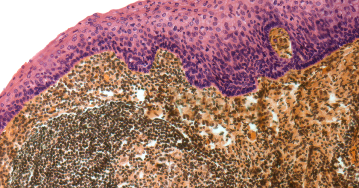 3D tissue models mimic the human immune system to inform drug ...